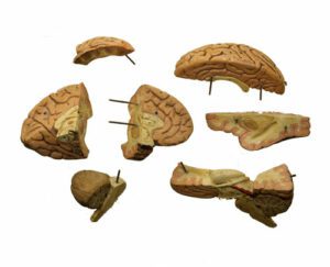Human brain model - Van Leest Antiques