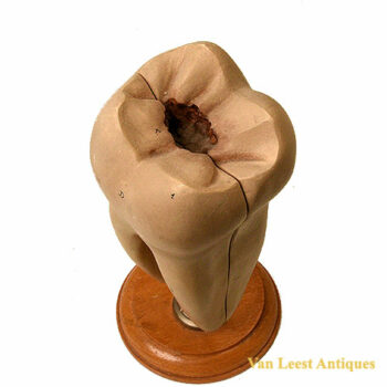 Anatomical lower Molar model, Somso