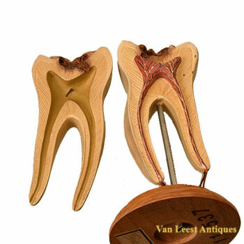 Anatomical lower Molar model, Somso