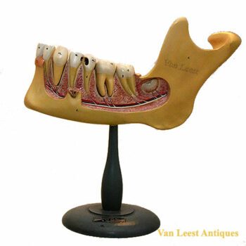 Anatomical lower jaw model Somso Anatomical lower jaw model,