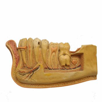 Lower jaw anatomical model by Somso