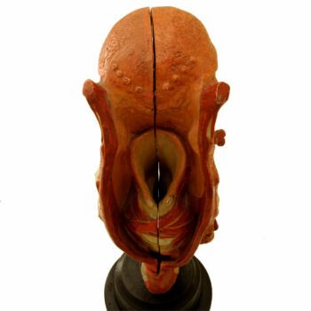 Anatomical Pharynx-Larynx model.somso